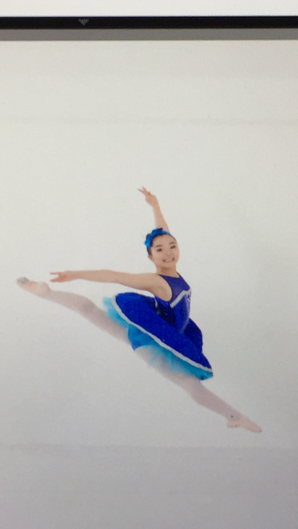 Angel Baton Philippines